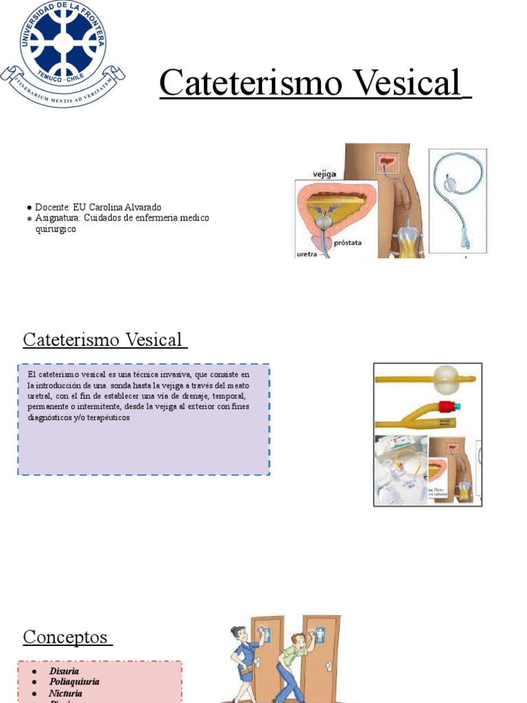 Cateterismo Vesical | PDF | Vejiga urinaria | Especialidades Quirúrgicas