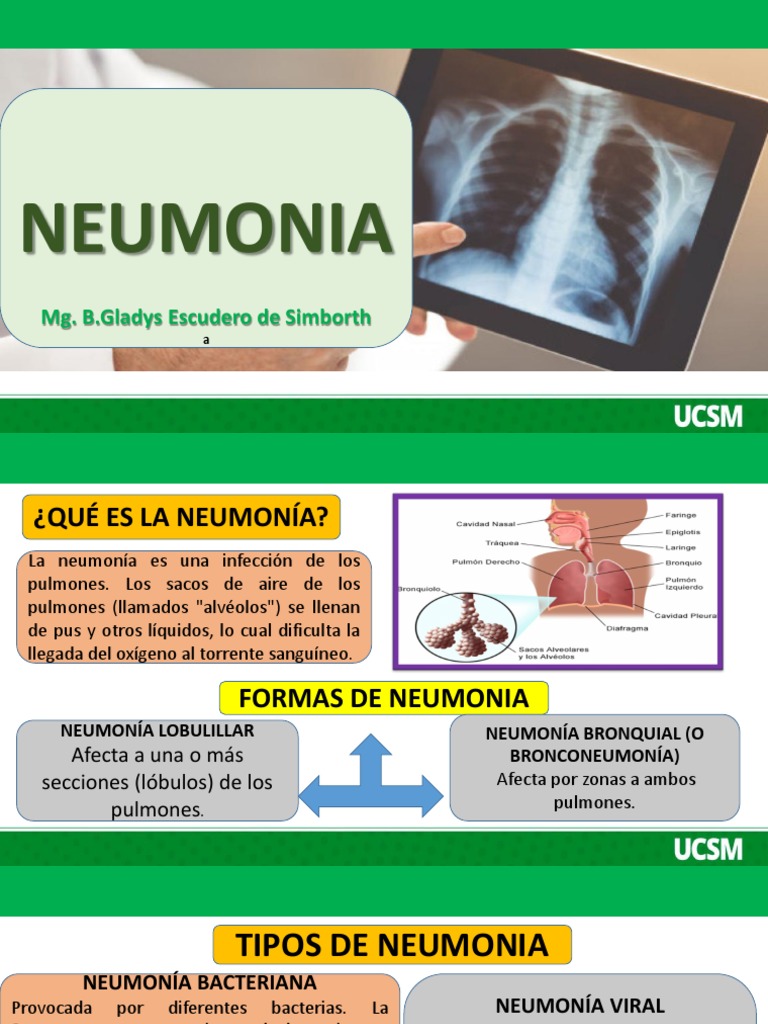 Neumonia 28-4 - 22 | PDF | Neumonía | Enfermedades respiratorias Neumonia 28-4 - 22 | PDF | Neumonía | Enfermedades respiratorias