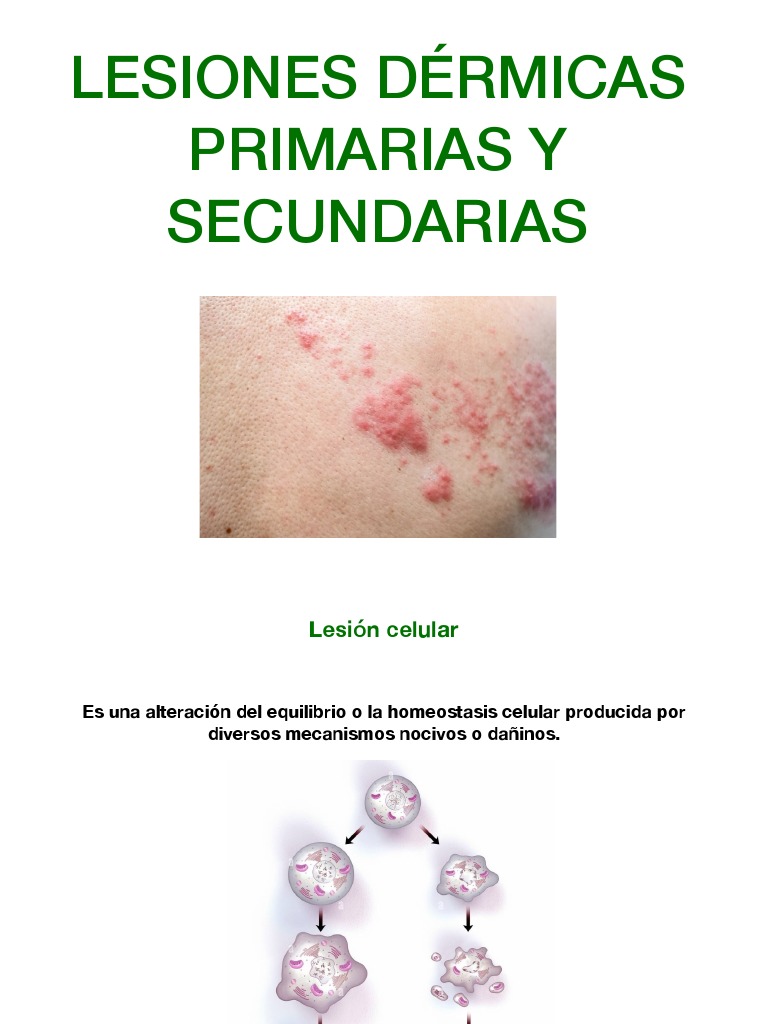 Lesiones Dérmicas - 021720 | PDF | Piel | Medicina