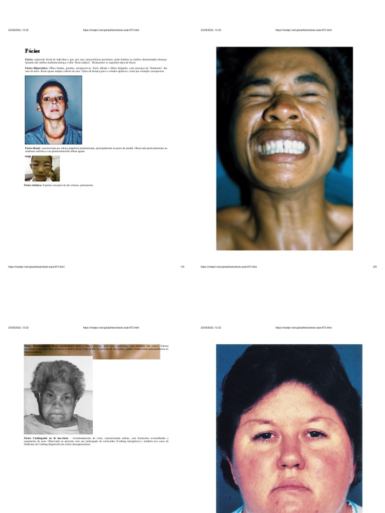 Facies | PDF