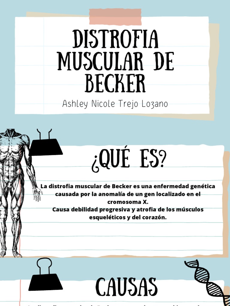 Distrofia Muscular de Becker Corregida | PDF