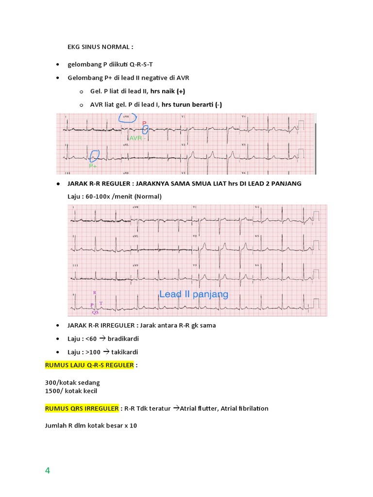 EKG Sinus Normal dan Bradikardi | PDF
