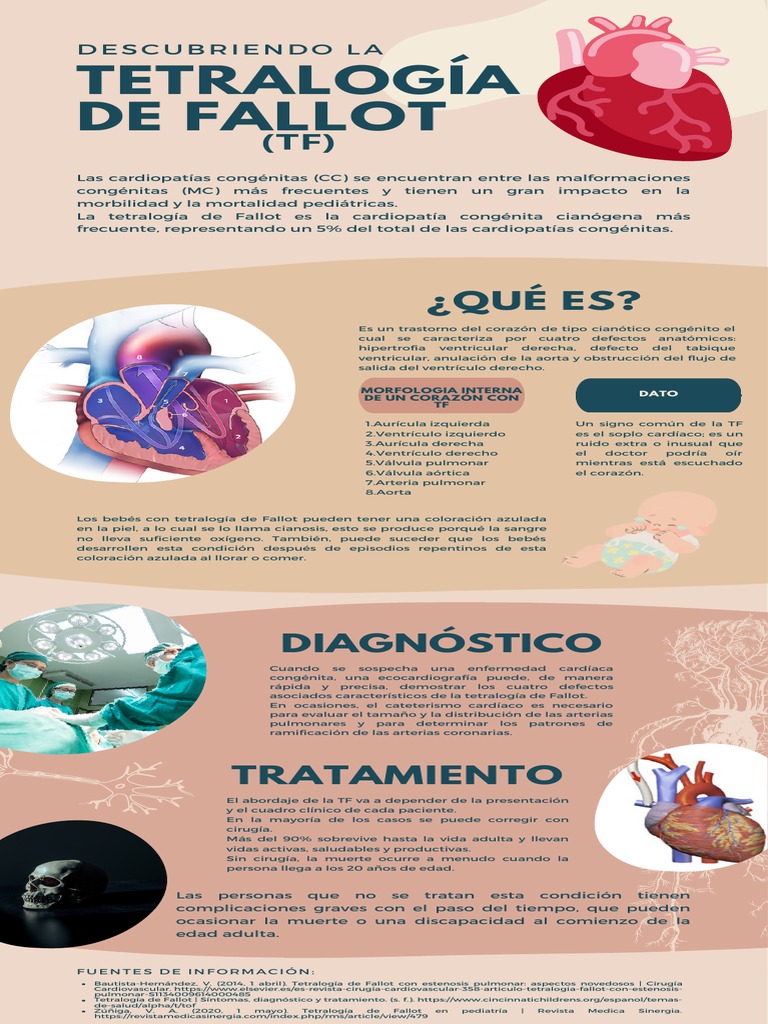 Infografia Tetralogia de Fallot | PDF | Defecto cardiaco congenito ...