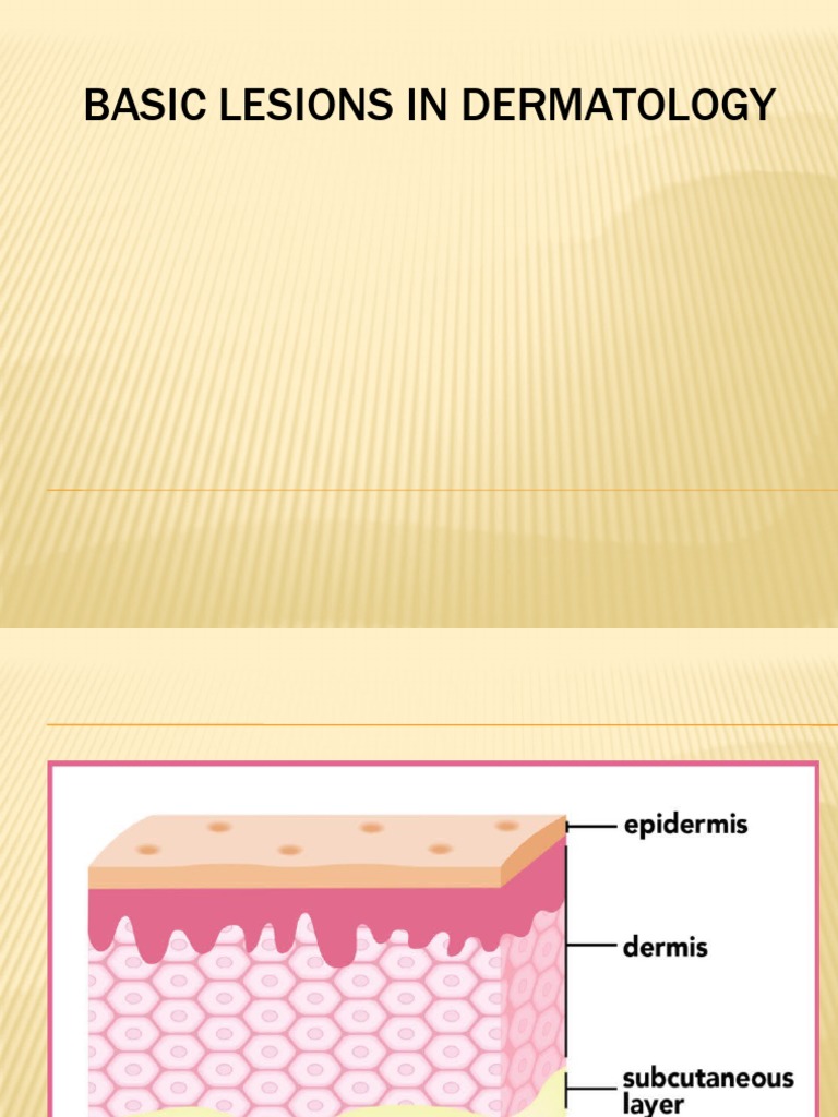 Basic Lesions in Dermatology | PDF