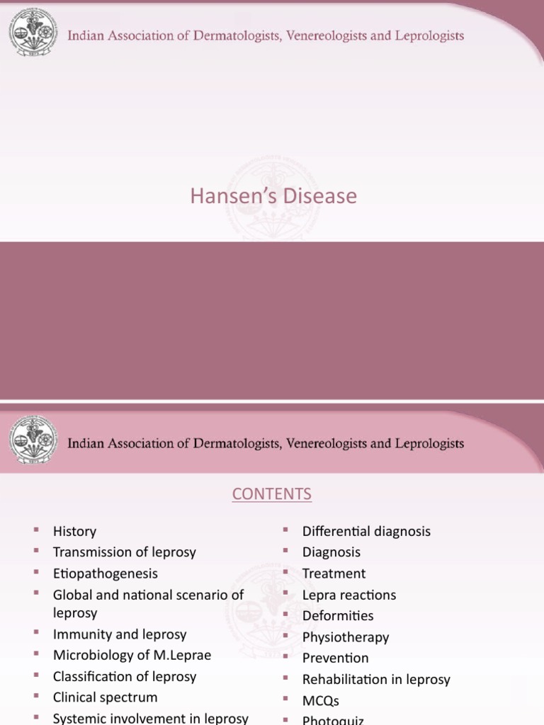 Hansens Disease | PDF | Leprosy | Peripheral Neuropathy