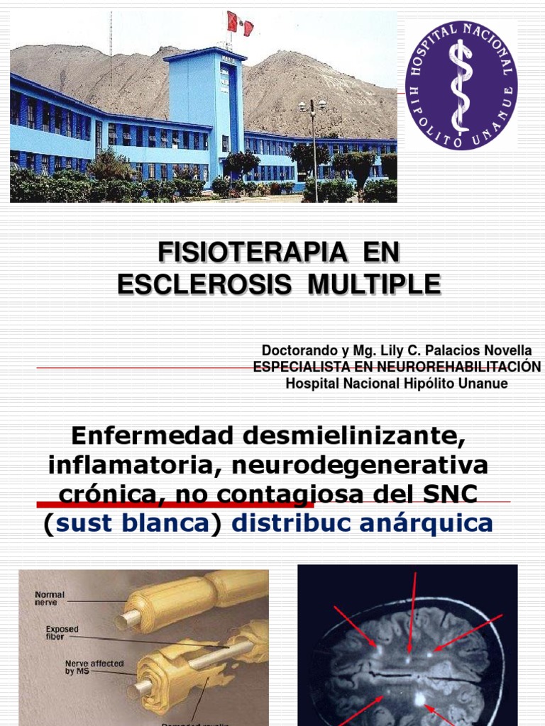 Fisioterapia en Esclerosis Múltiple | PDF