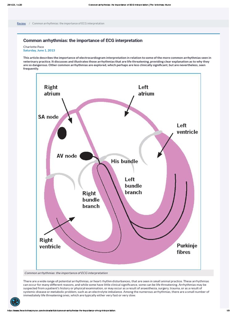 Common arrhythmias - the importance of ECG interpretation | PDF ...