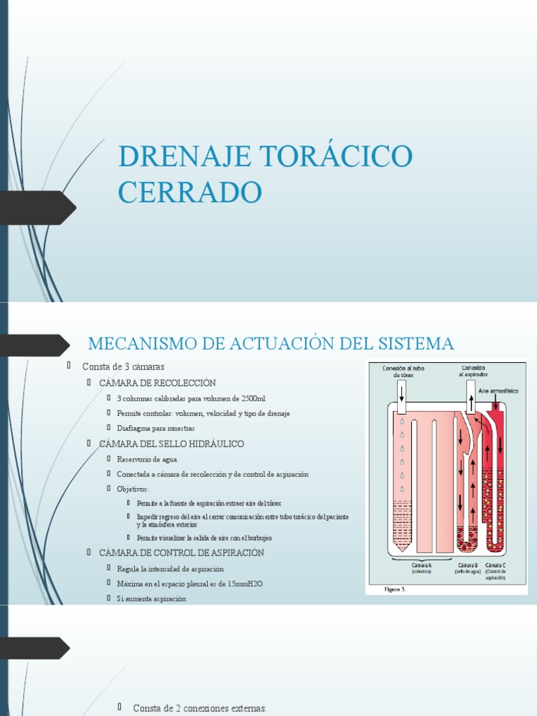 Drenaje Torácico Cerrado | PDF