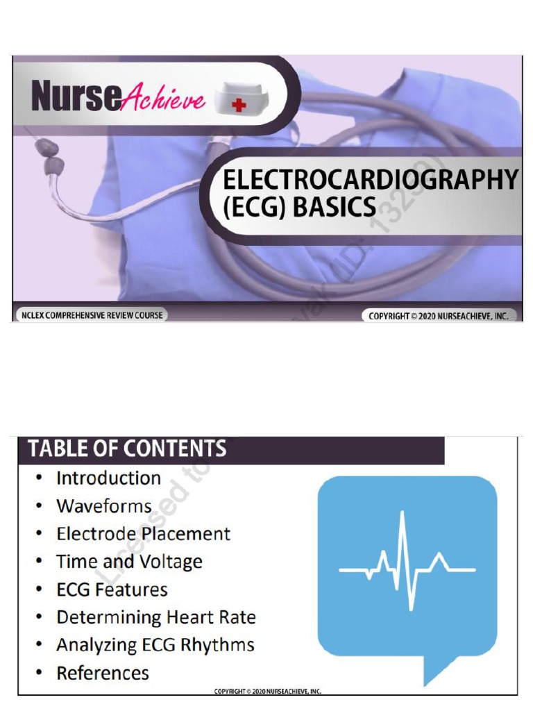 ECG Nurse Achieve | PDF