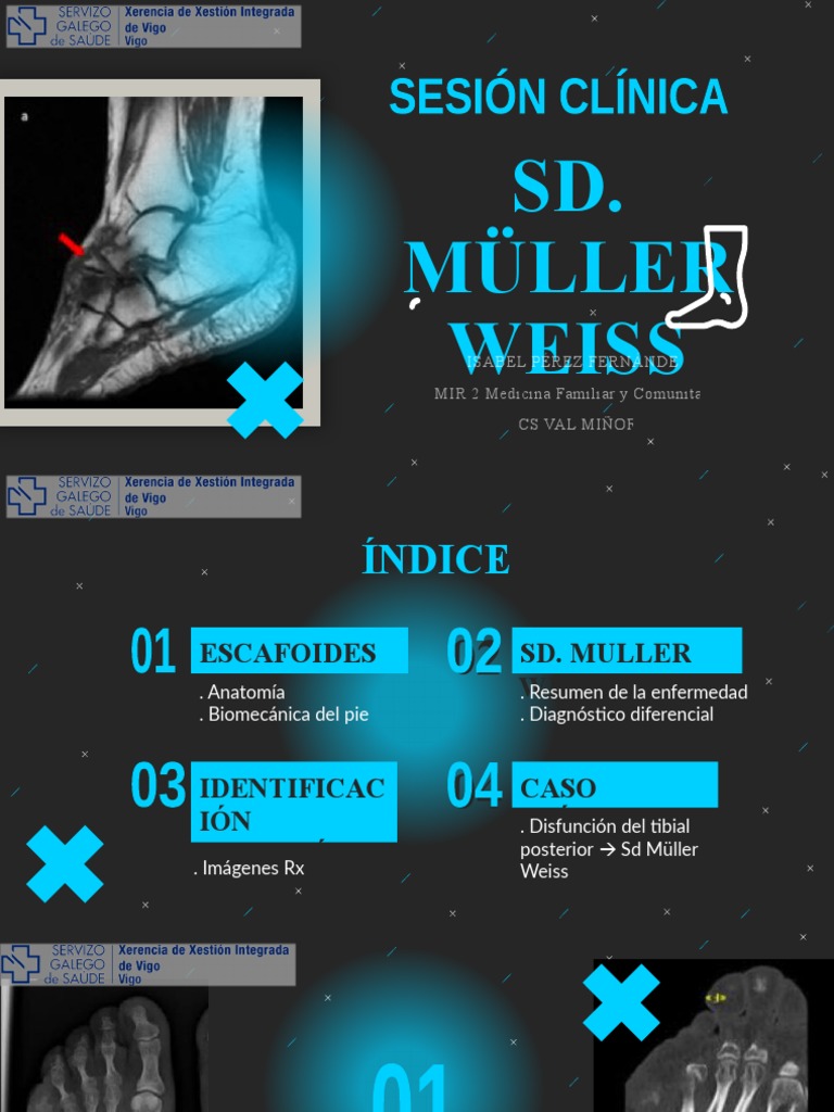 Sd. Muller Weiss | PDF | Pie | Sistema esquelético