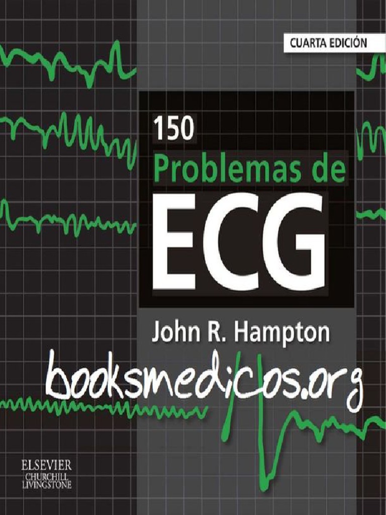 150 Problemas de ECG | PDF