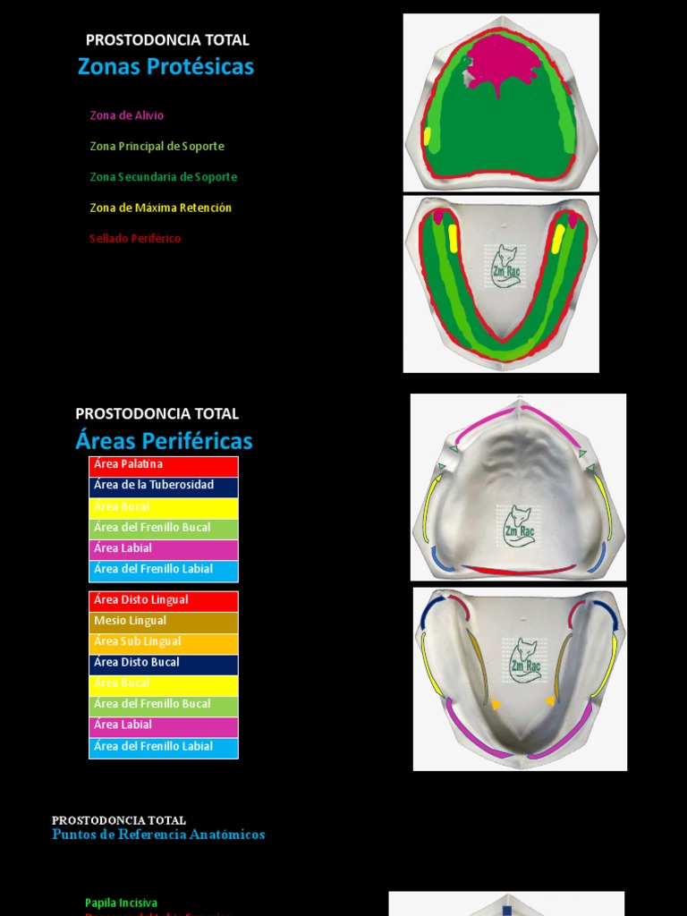 Modelos de Estudio-Anatomia Del Desdentado | PDF | Lengua | Anatomía