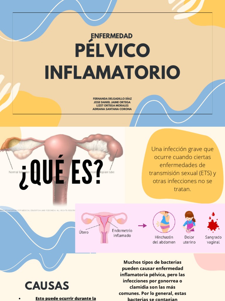 Enfermedad Pélvico Inflamatorio | PDF | Infección transmitida sexualmente | Especialidades Medicas