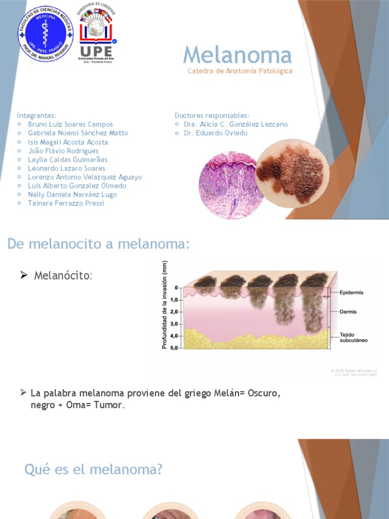 Melanoma Pdf Epidermis Piel