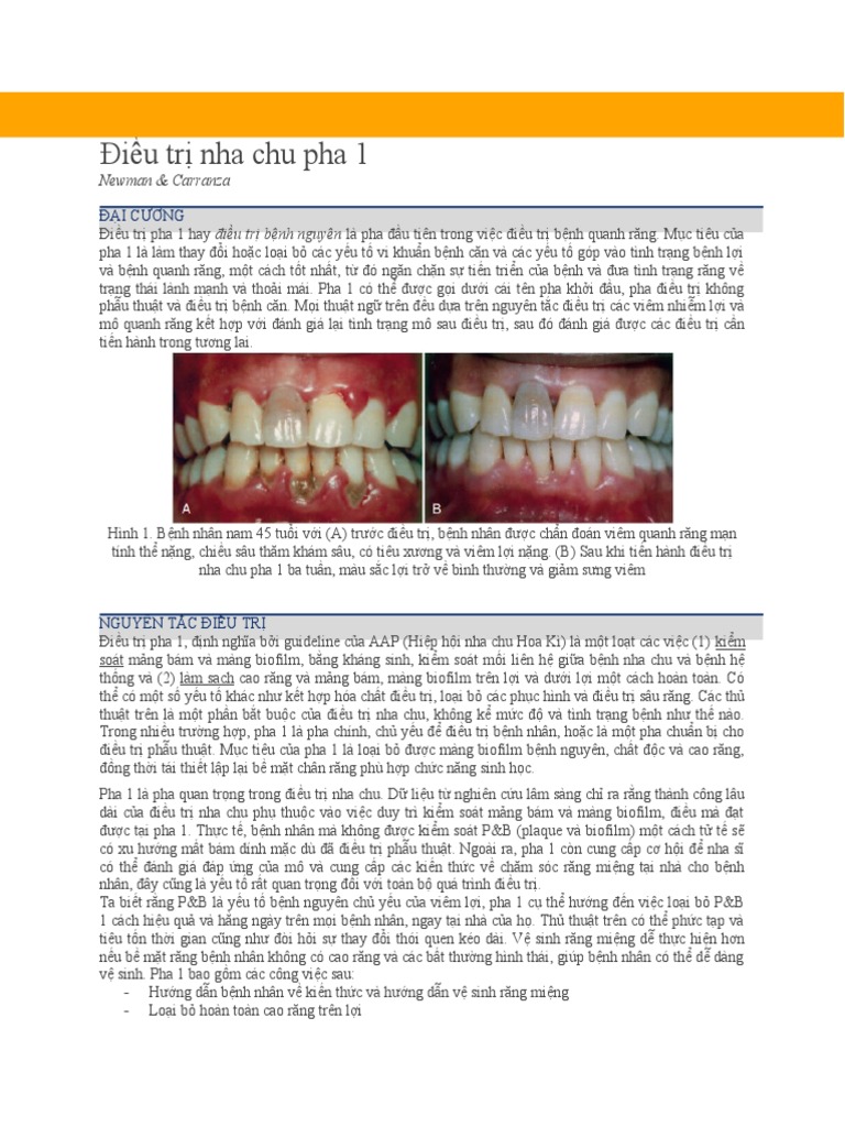 Điều trị nha chu pha 1 | PDF