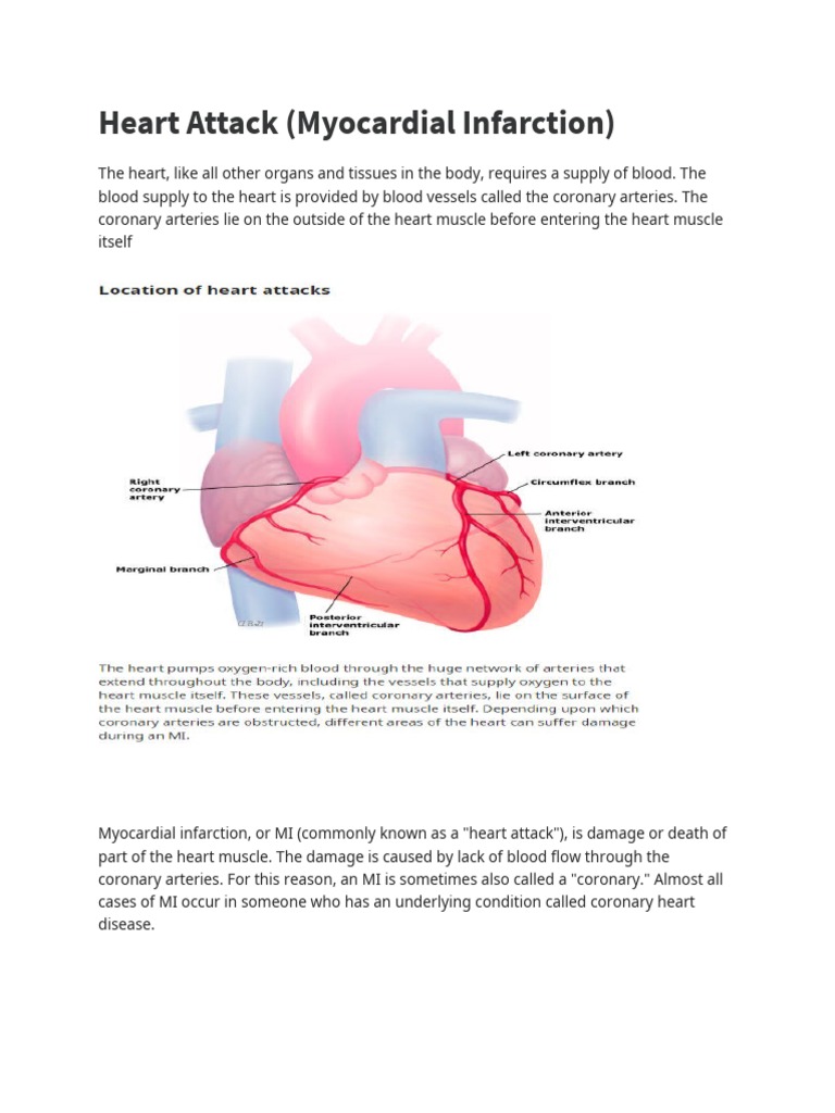 Heart Attack | PDF