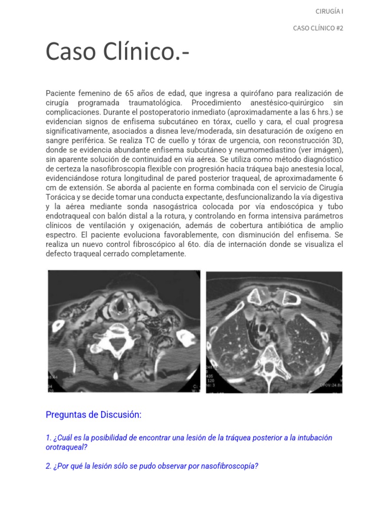 Caso Clínico - 2. CX I | PDF