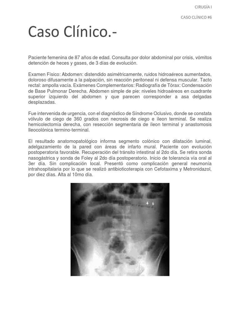 Caso Clínico - 6. CX I | PDF