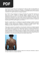 Prueba de Adams | PDF | La columna vertebral | Escoliosis