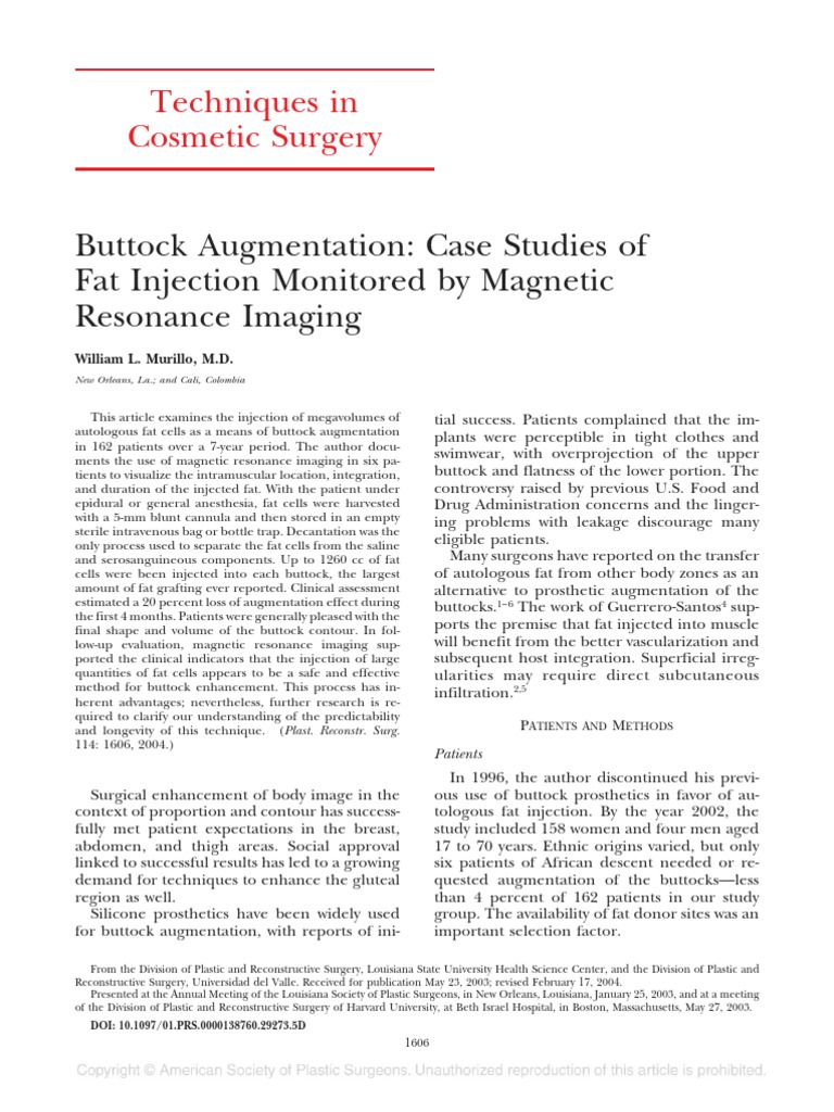 Cosmetic Surgery: MRI-Guided Fat Injection | PDF | Medical Specialties | Clinical Medicine