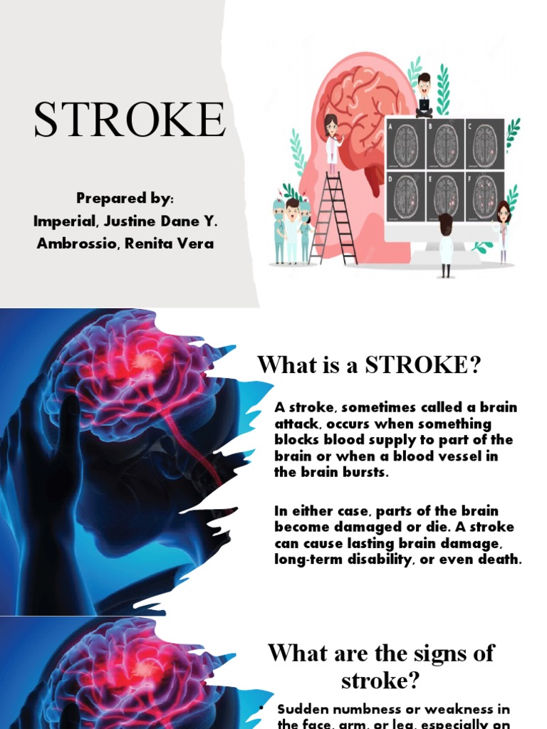 STROKE | PDF | Stroke | Ischemia