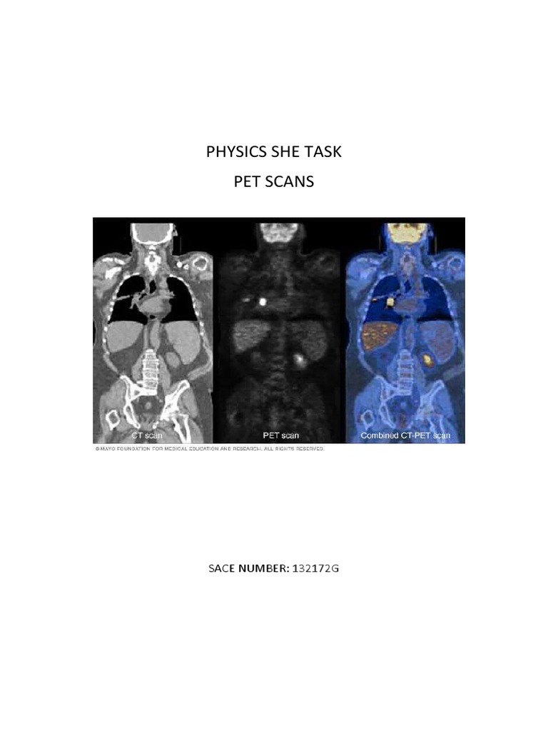 Understanding PET Scans in Oncology | PDF | Positron Emission ...