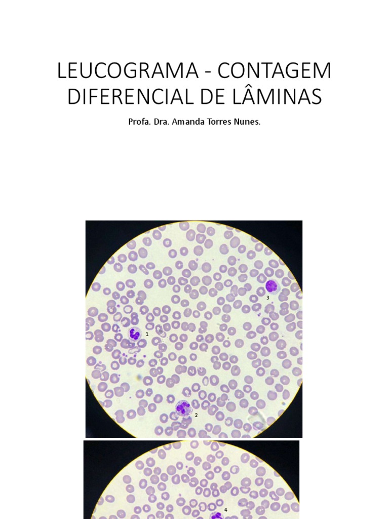 Leucograma - Cont. Diferenc. Lâminas - 3 | PDF