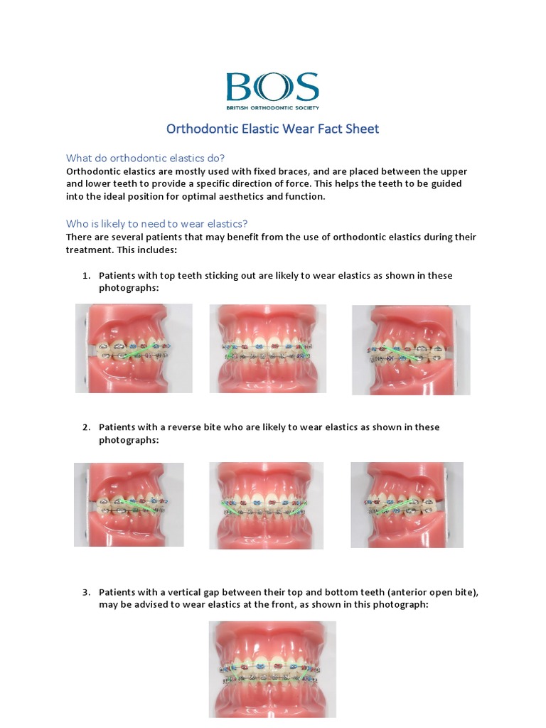 Orthodontic Elastic Wear Fact Sheet Diagrams | PDF | Orthodontics ...