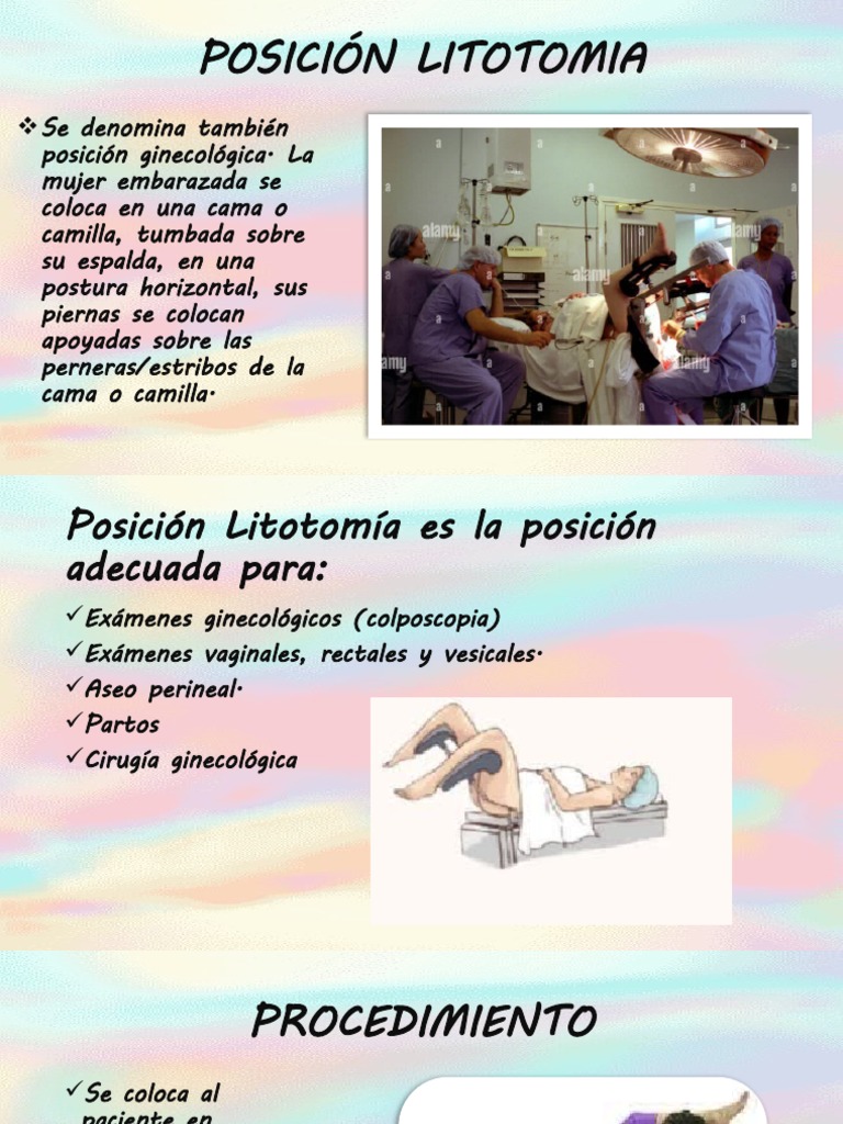 Posición Litotomia | PDF