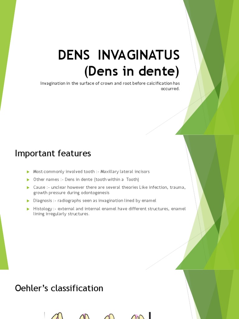 Dens EVAGINATUS and Invaginatius | PDF