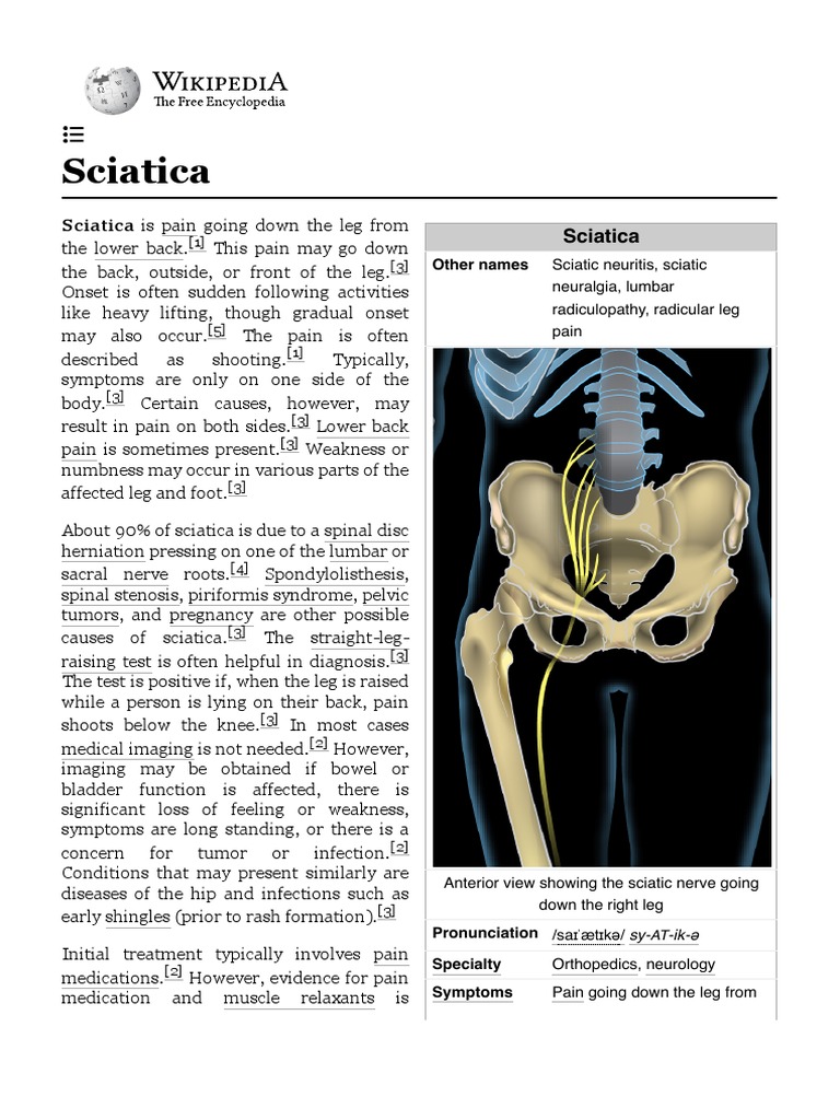 Sciatica - Wikipedia | PDF