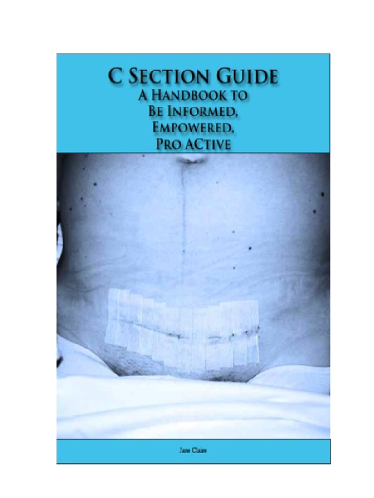 C-Section Guide | PDF | Caesarean Section | Childbirth