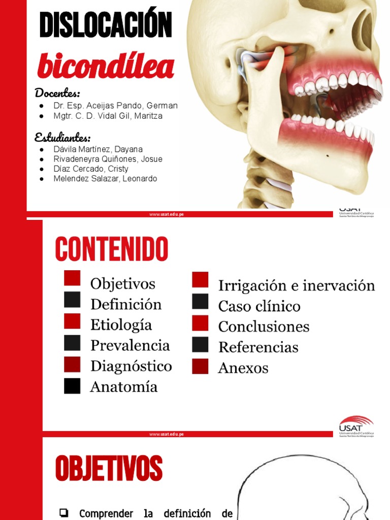 Dislocación Bicondilea | PDF | Sistema musculoesquelético | Medicina ...