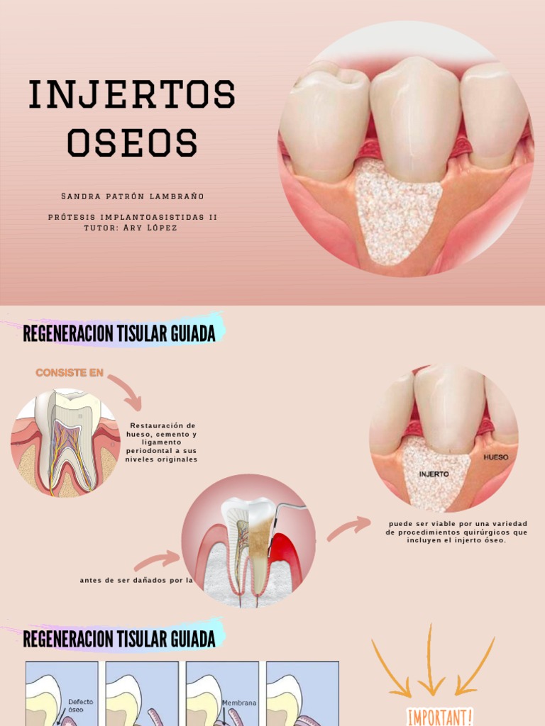 Injertos Oseos | PDF | Hueso | Regeneración (biología)