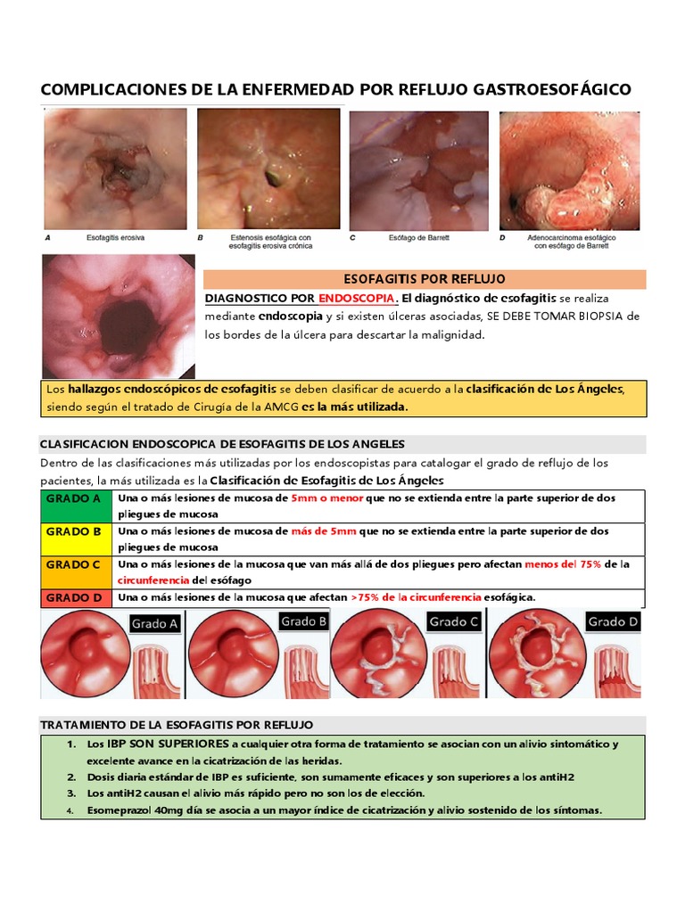 Complicaciones Del Erge | PDF | La enfermedad por reflujo ...