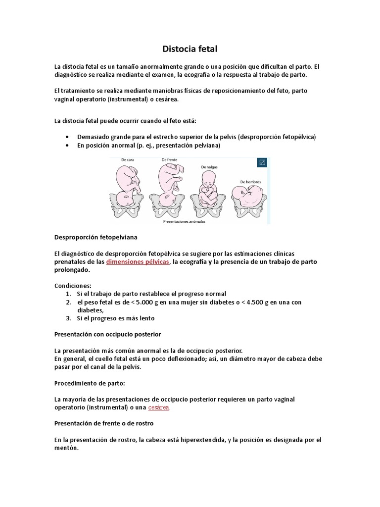 Distocia fetal: causas y tratamientos | PDF | Parto | Ciencias de la Salud