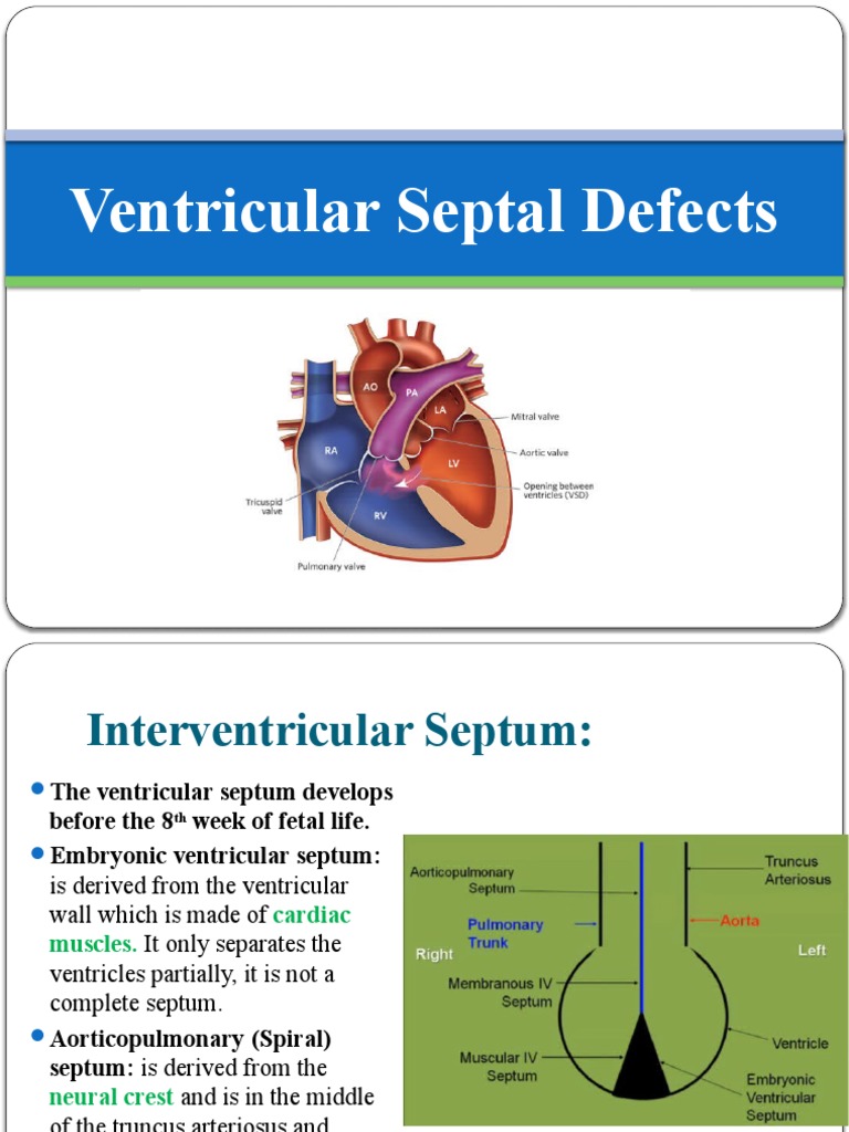 Ventricular Septal Defect | PDF | Ventricle (Heart) | Congenital Heart ...