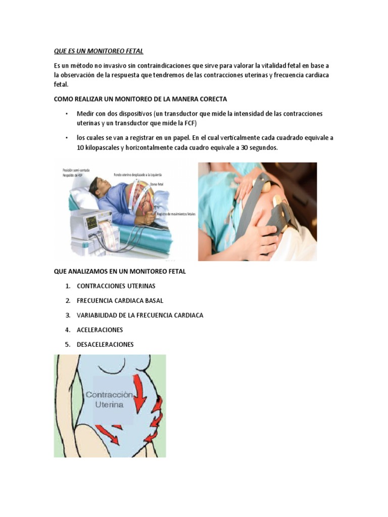 QUE ES UN MONITOREO FETAL | PDF