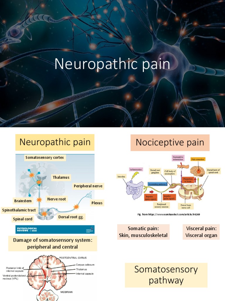 Neuropathic Pain | PDF
