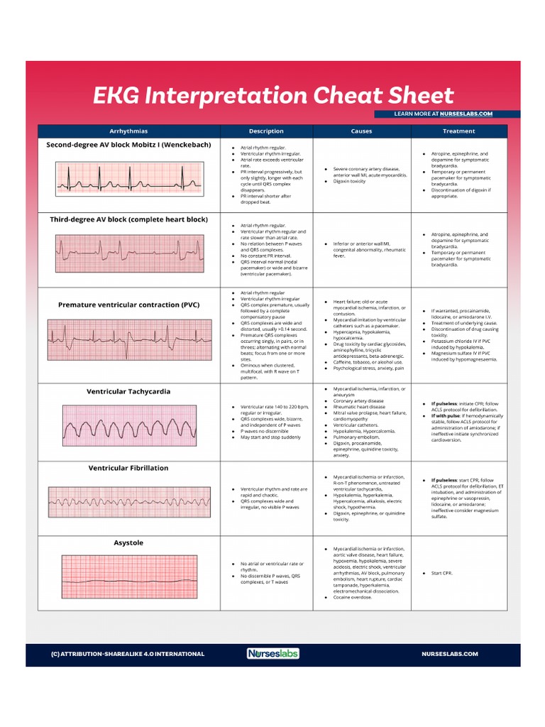 EKG Interpretation Cheat Sheet For Heart Arrhythmias Nurseslabs 3 | PDF