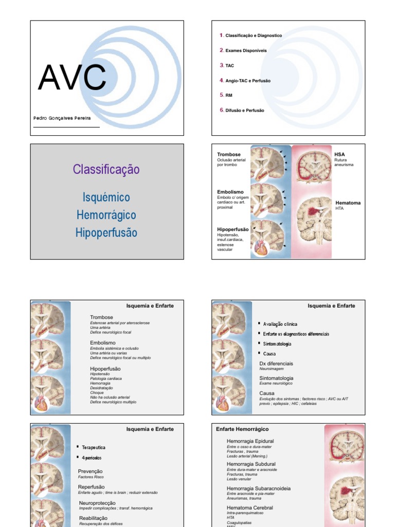 Avc 2023 | PDF | Infarto do Miocárdio | AVC