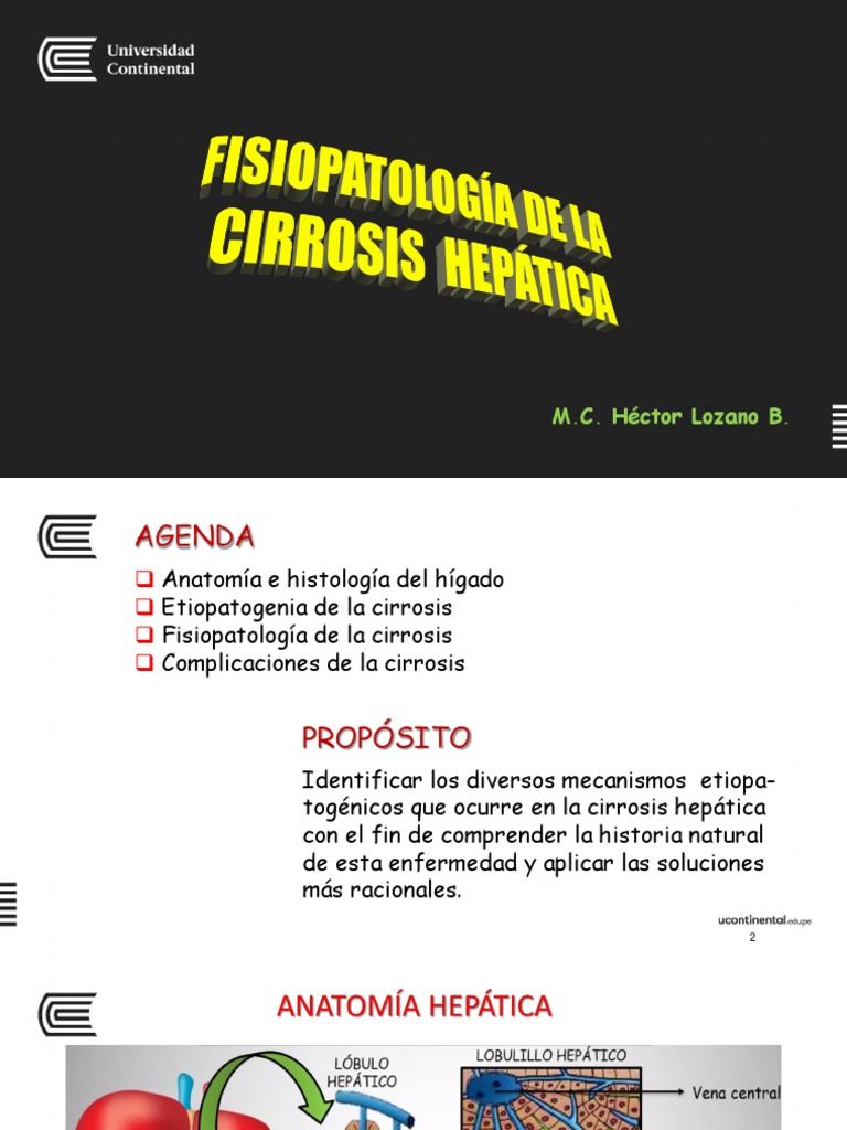 Fisiopatologia de La Cirrosis Hepatica | PDF | Cirrosis | Hígado