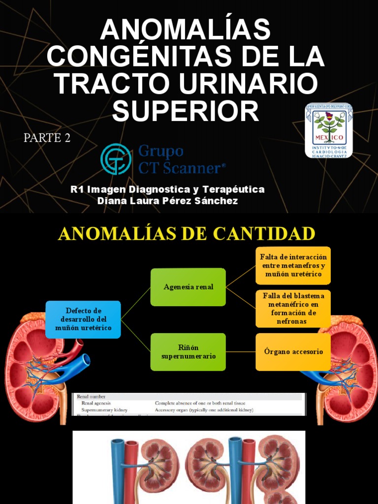 Anomalías Congénitas de La Tracto Urinario Superior | PDF | Condiciones urológicas ...