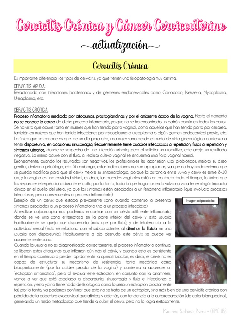 Actualización en Cervicitis Crónica y Cáncer Cervicouterino | PDF | Virus | Cáncer