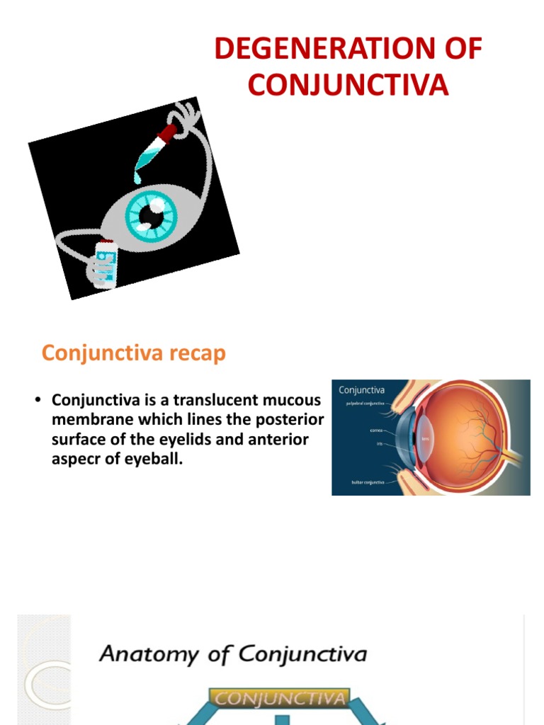Degeneration of Conjunctiva | PDF | Causes Of Death | Human Eye