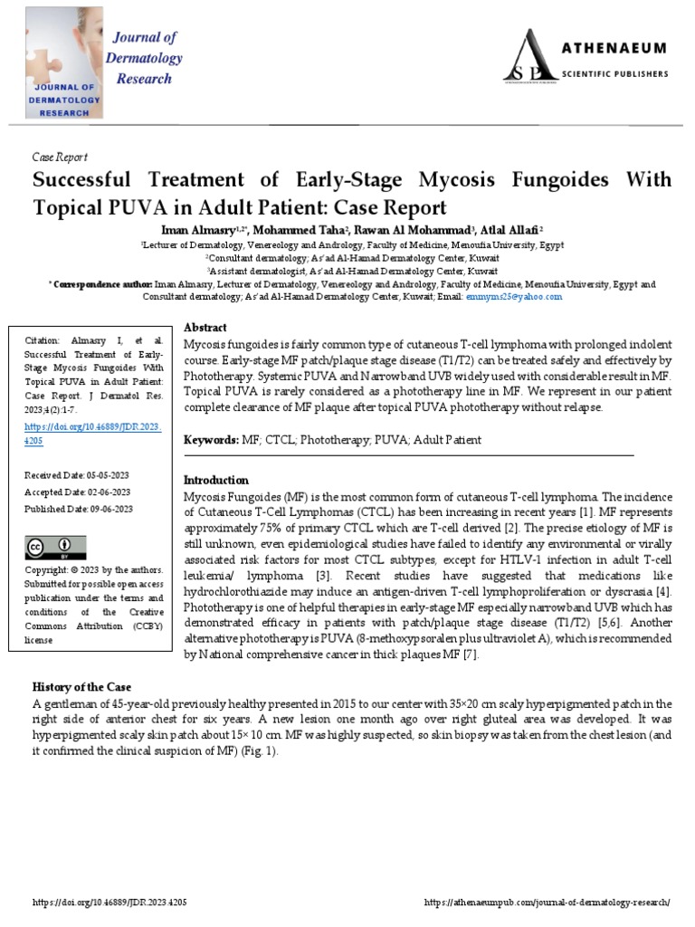 Successful Treatment of Early Stage Mycosis Fungoides With Topical PUVA ...