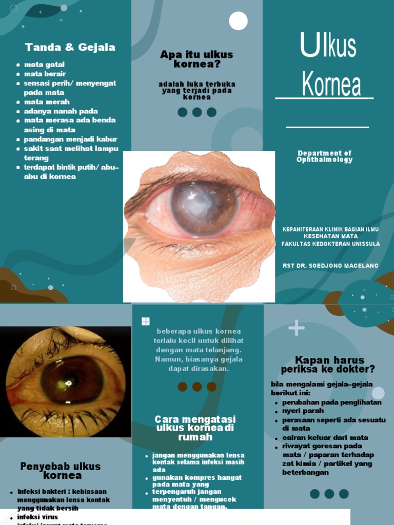 leaflet ulkus kornea-dikonversi | PDF