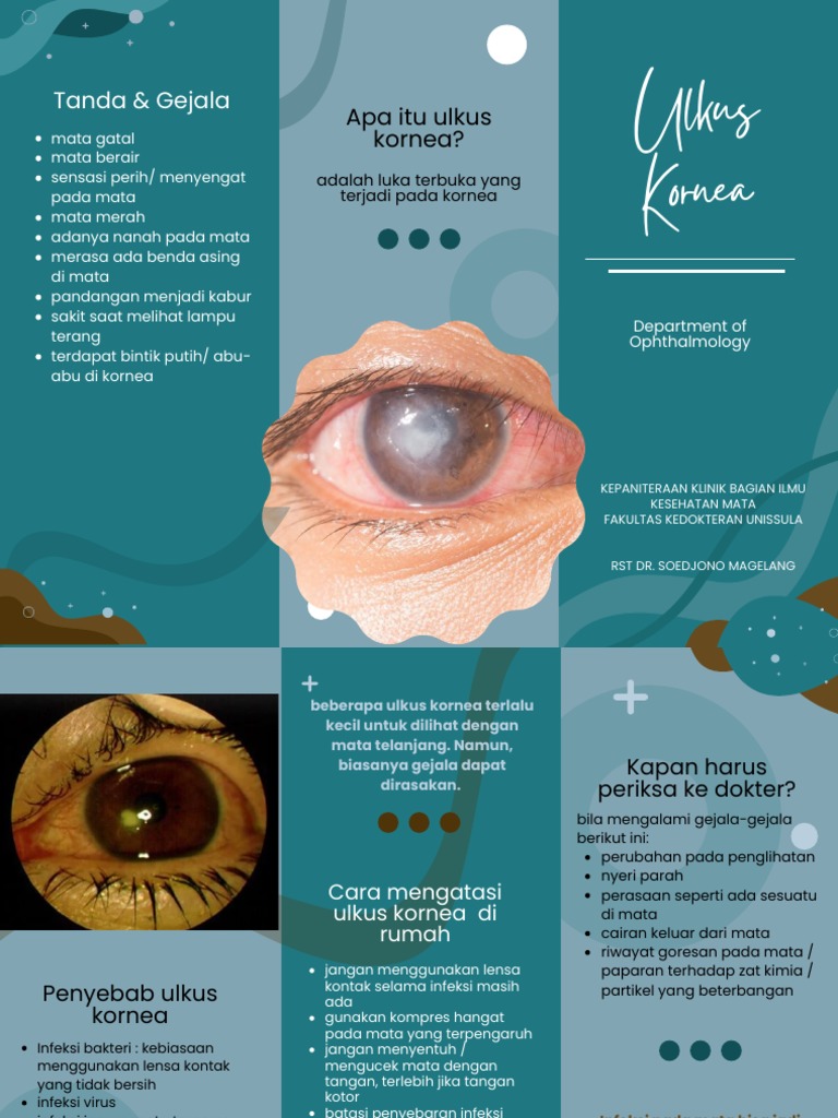 Leaflet Ulkus Kornea | PDF
