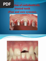 Management of Supraerupted Teeth | PDF | Tooth | Dentistry