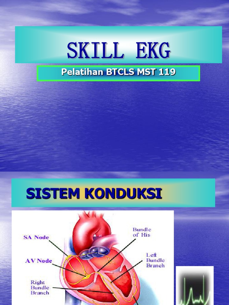 Ekg Skill 119 | PDF